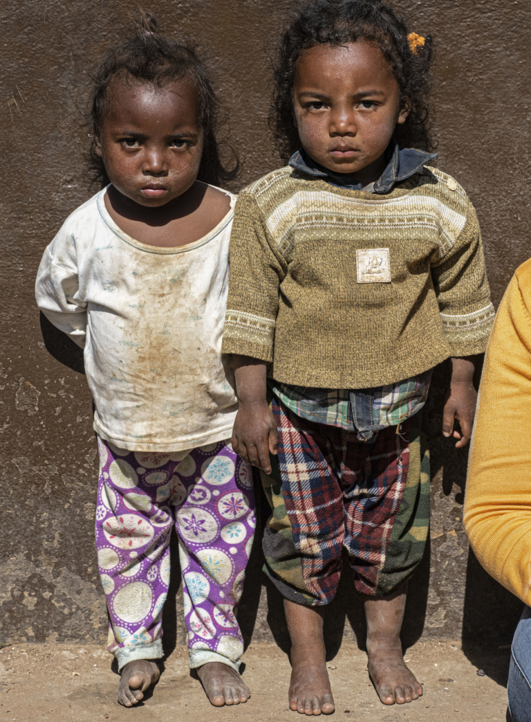 E MAD02 Kambana YA - Kika